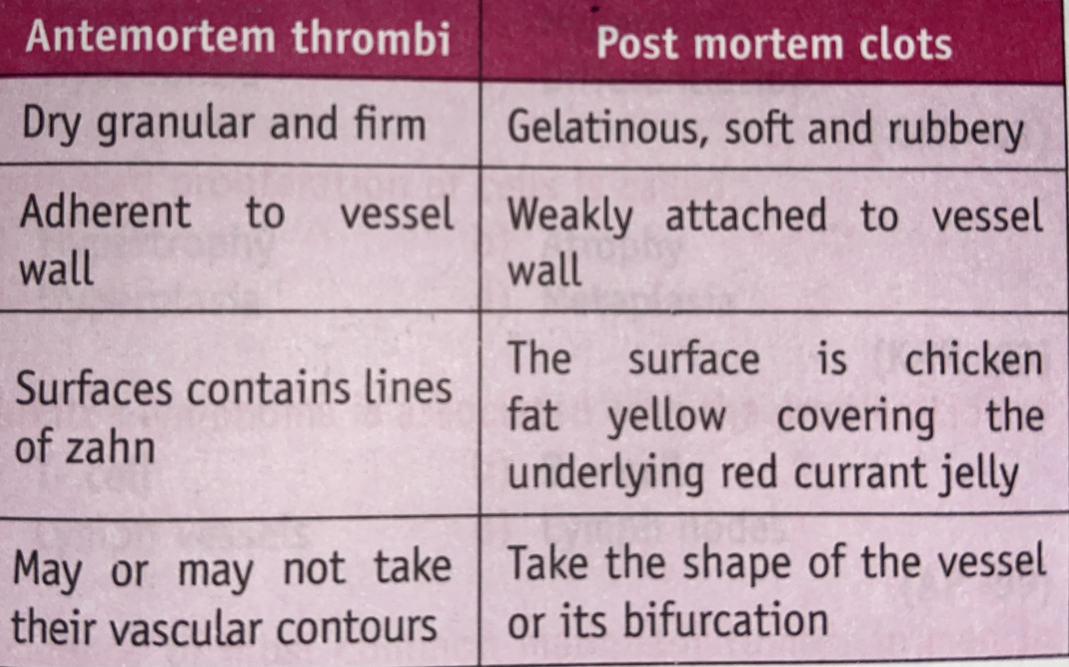 DIFFERENCE BETWEEN ANTEMORTEM THROMBI AND POST MORTEM CLOTS – Dentowesome