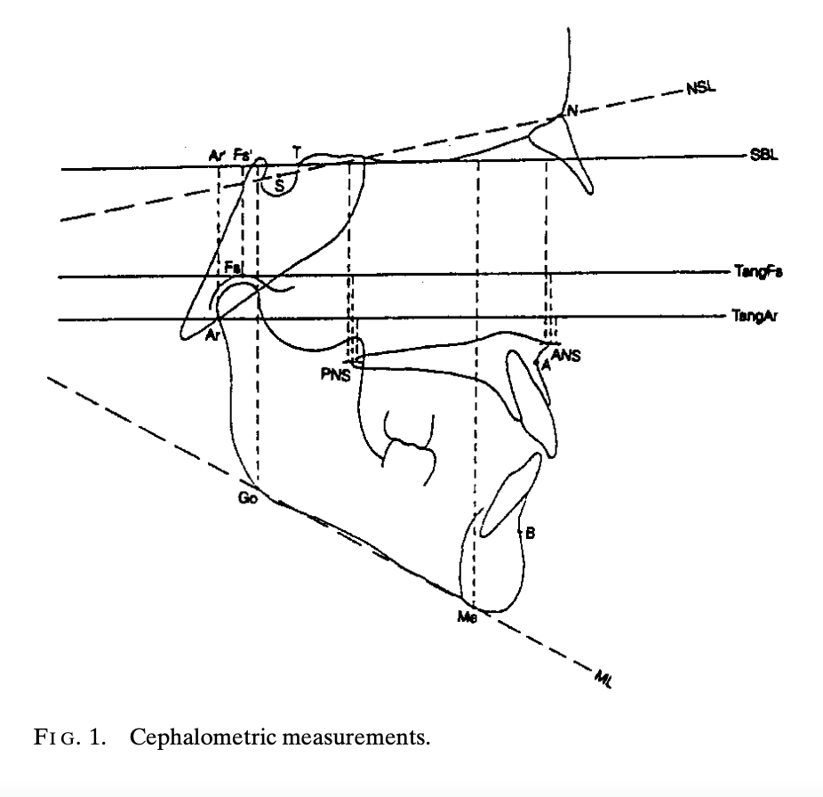 Glenoid Fossa Position in Different Facial Types – Dentowesome