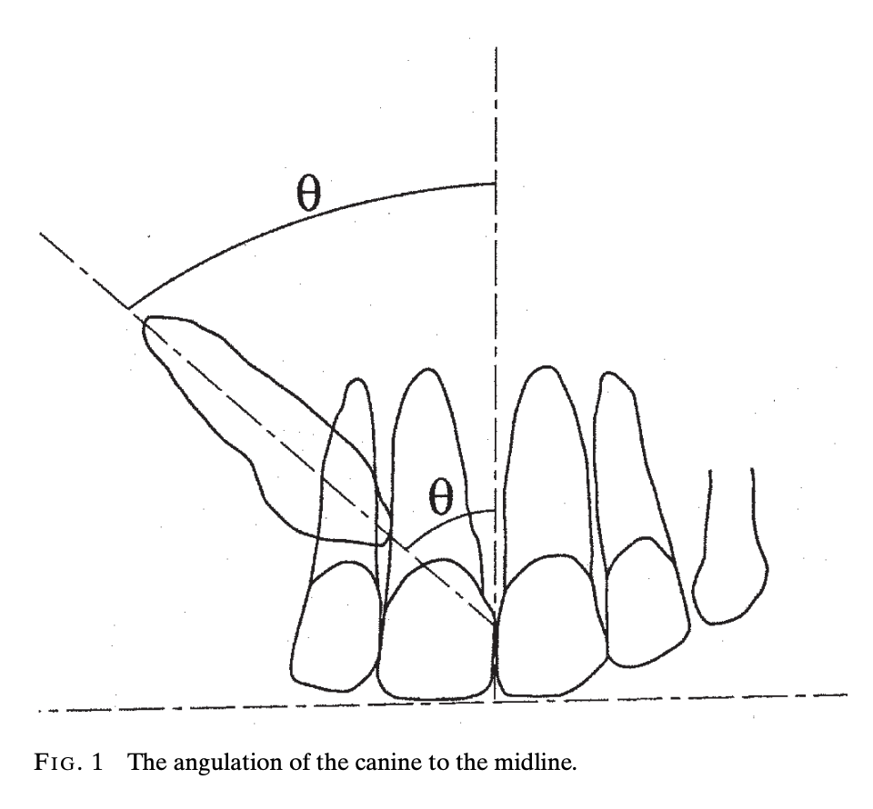 Radiographic Factors Affecting the Management of Impacted Upper ...